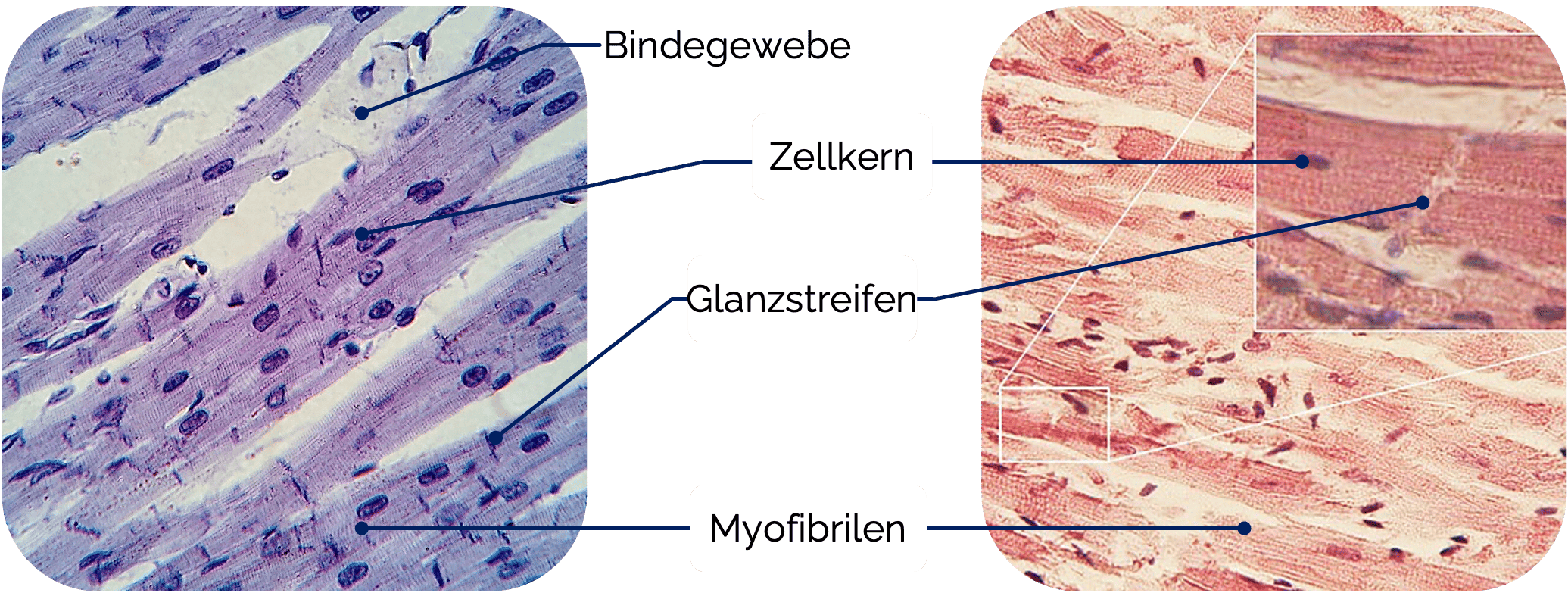 Herzmuskulatur - Medi Know
