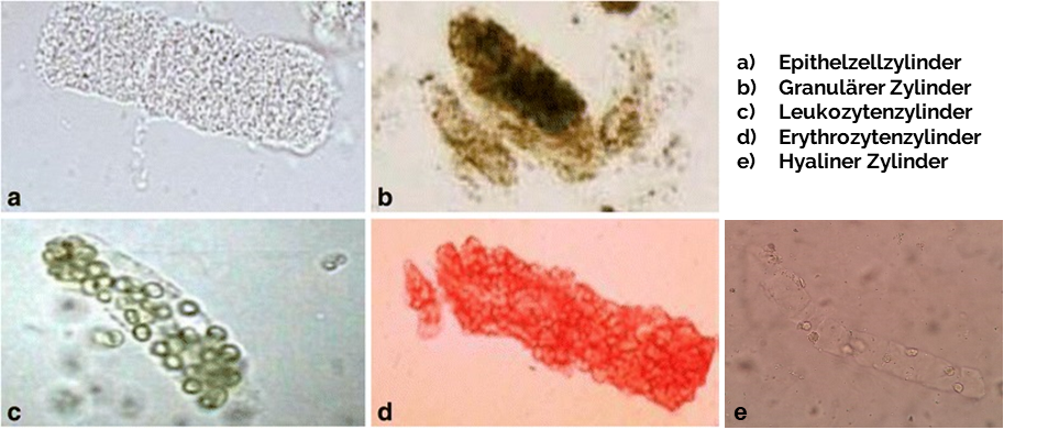 Diagnostik in der Nephrologie - Medi Know